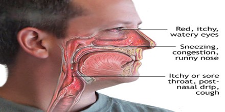 About Pollen Allergy - Assignment Point