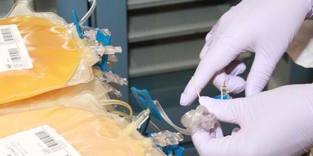 FFP: Fresh Frozen Plasma - Assignment Point