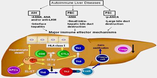 Autoimmune Hepatitis - Assignment Point