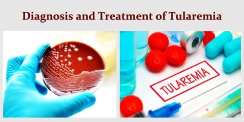 Tularemia (Symptoms, Diagnosis, Treatment, and Prevention) - Assignment ...